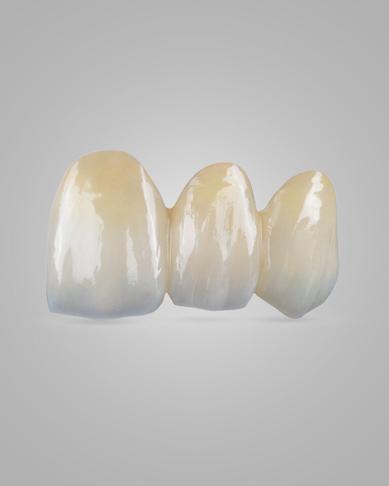 Zirconia Restorations – Esthetic Dental Laboratory