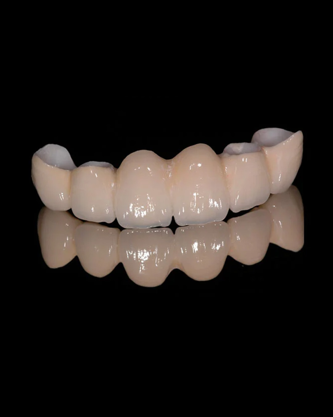 Super High Translucency Multi-Layers Zirconia – Esthetic Dental Laboratory